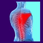 Back Muscle Injury - Back Pain