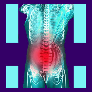 Back Pain Flare Up - Back Pain