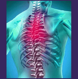 Back Pain from Falling - Back Pain