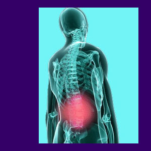 Back Pain Medicine - Back Pain