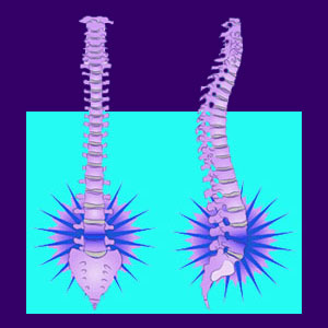 Broken Back - Back Pain