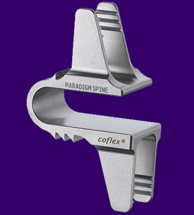 Coflex Implant - Back Pain