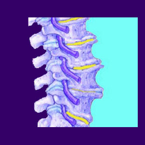 Compressive Neuropathy - Back Pain