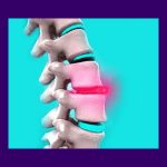 Discitis - Back Pain