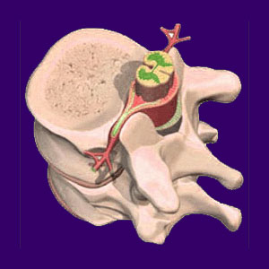 Epidural Space - Back Pain