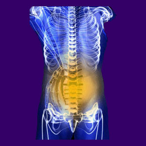 Flat Back - Back Pain
