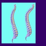 Hypermobile Joint Back Pain - Back Pain