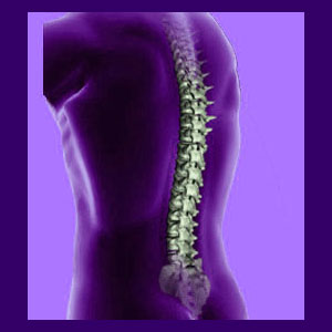 Hyperkyphosis - Back Pain