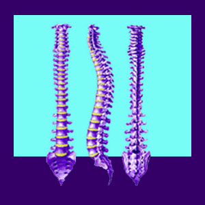 Listhesis - Back Pain