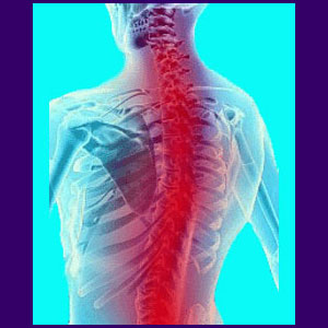 Neurological Consequences of Back Pain - Back Pain