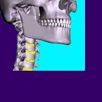 Osteophytes - Back Pain