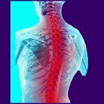 Psychogenic Back Pain - Back Pain