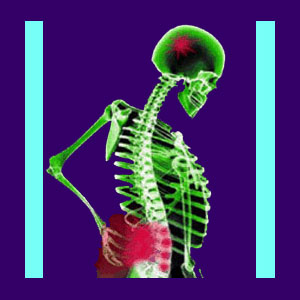 Psychological Back Pain - Back Pain