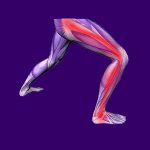 Radiculitis - Back Pain