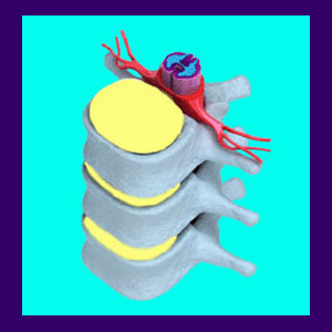 Radiofrequency Lesioning - Back Pain