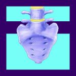 Sacralization - Back Pain
