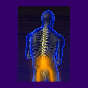 Saddle Anesthesia - Back Pain