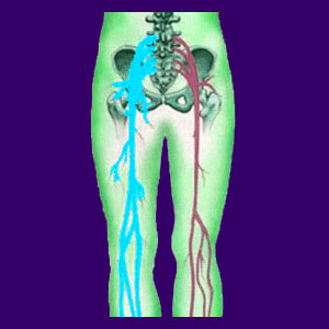 Sciatic Nerve - Back Pain