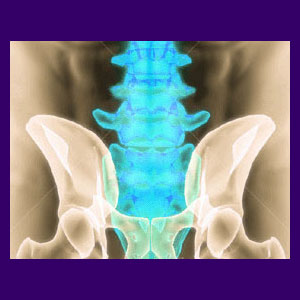 Spina Bifida Occulta - Back Pain