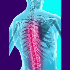 Spinal Cord Compression - Back Pain