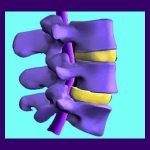 Spinal Dislocation - Back Pain