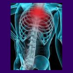 Spinal Misalignment - Back Pain