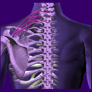 Spinal Nerve Injury - Back Pain