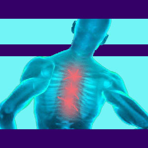 Spinal Syrinx - Back Pain