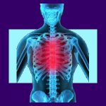 Stabbing Back Pain - Back Pain