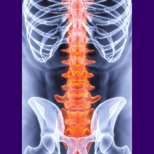 Straight Spine - Back Pain