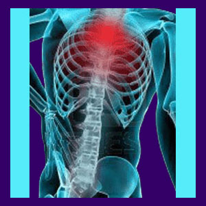 Thoracic Spinal Cord Injury - Back Pain