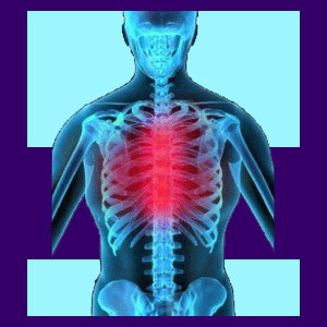 Upper Back Spasm - Back Pain